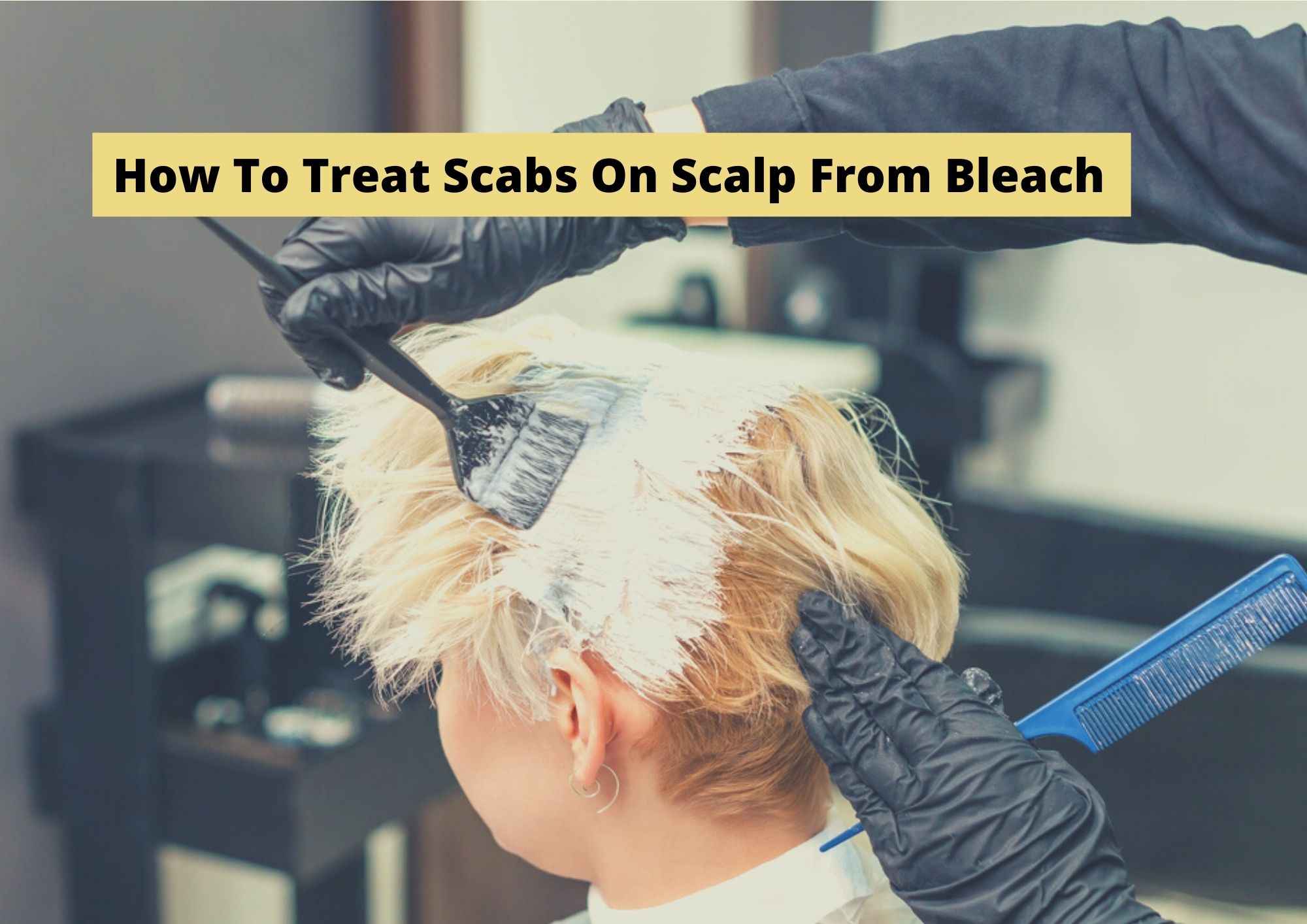 6 Tips On How To Treat Scabs On Scalp From Bleach 2026 | Treatments Fo ...